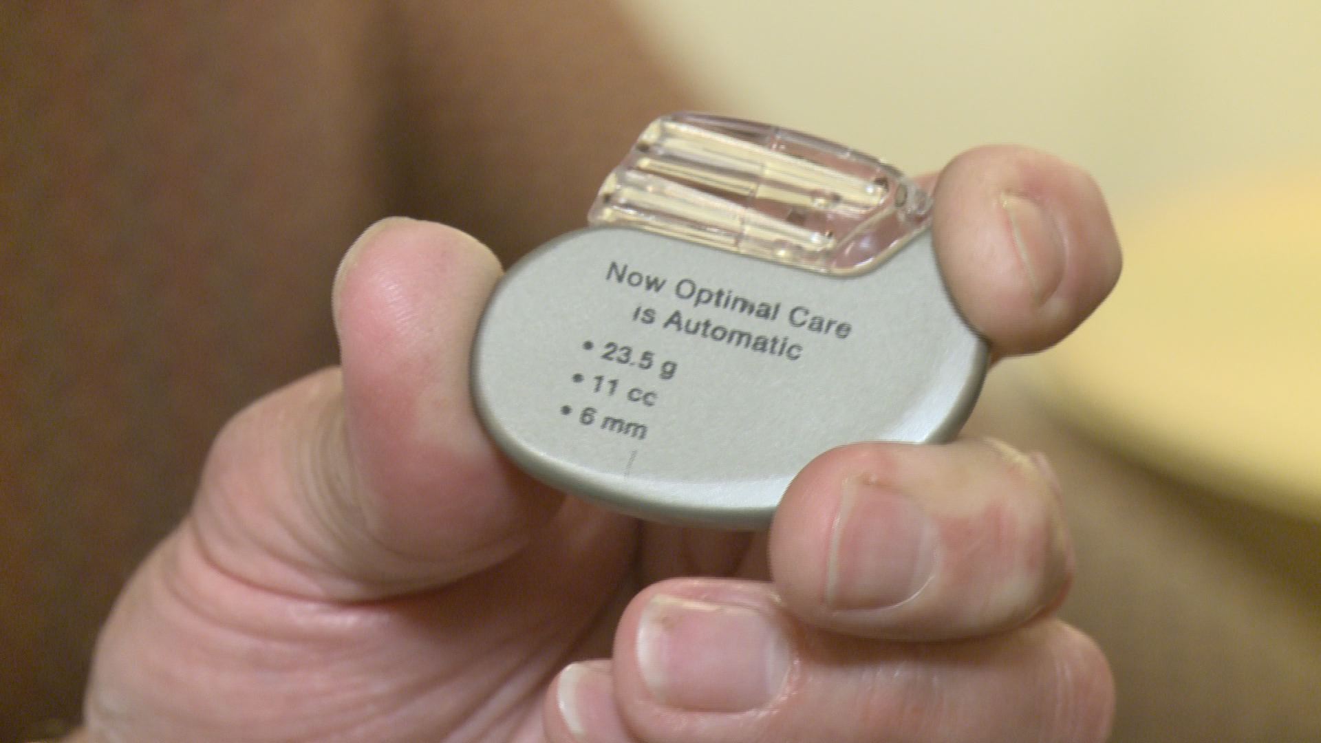 Patients test drive pacemakers before permanent implant | kare11.com